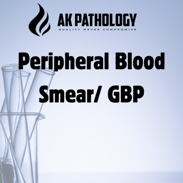 Peripheral Blood Smear/ GBP – AK Pathology – Best Pathology Lab